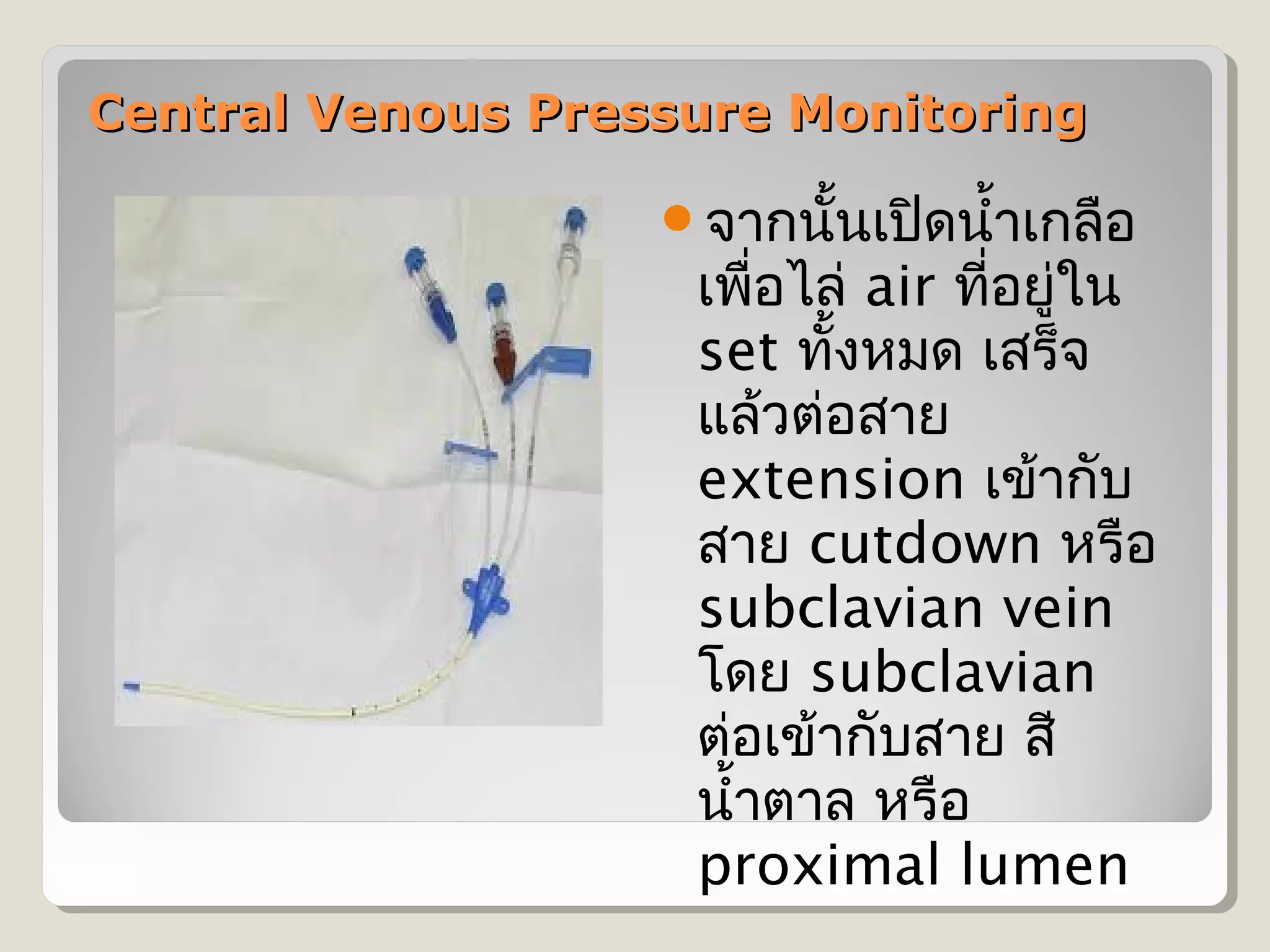 Cvp central venous pressure monitoring | PPT