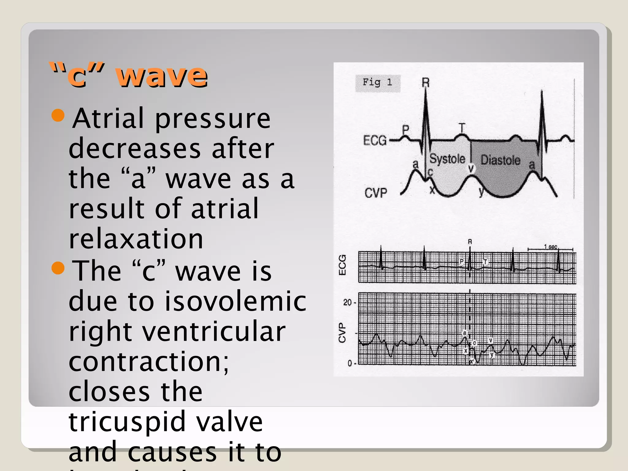 Cvp central venous pressure monitoring | PPT