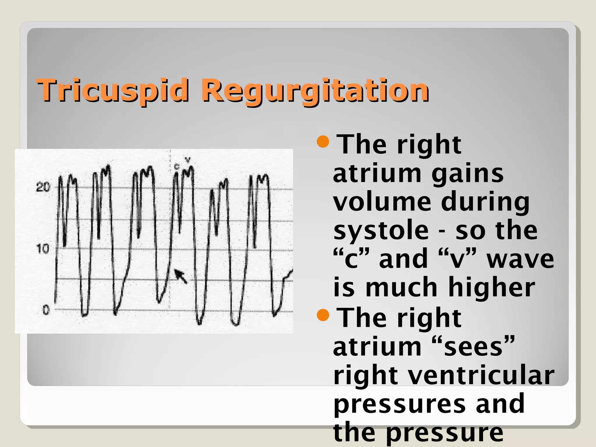 Cvp central venous pressure monitoring | PPT