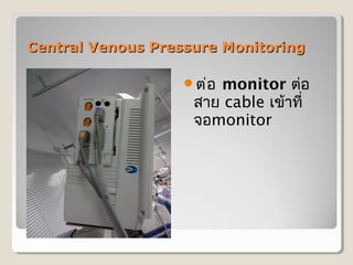 Cvp central venous pressure monitoring | PPT