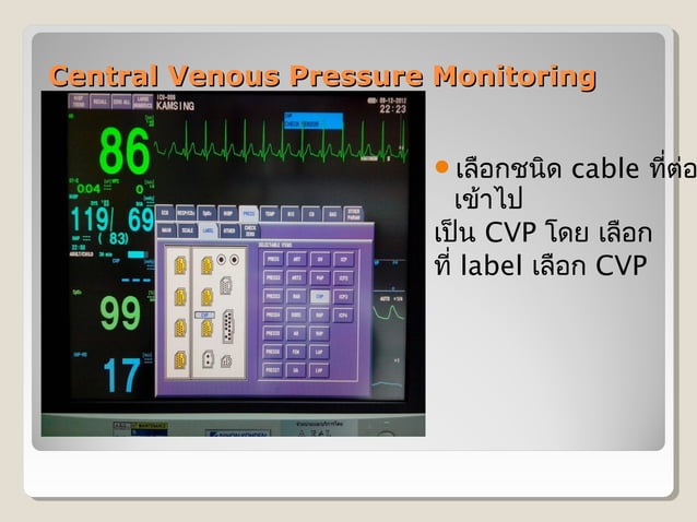 Cvp central venous pressure monitoring | PPT