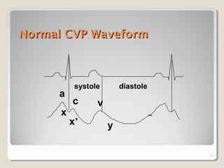Cvp central venous pressure monitoring | PPT