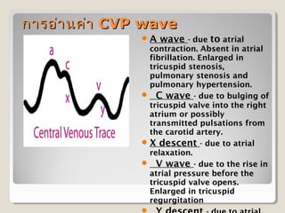 Cvp central venous pressure monitoring | PPT