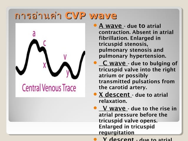 Cvp central venous pressure monitoring | PPT