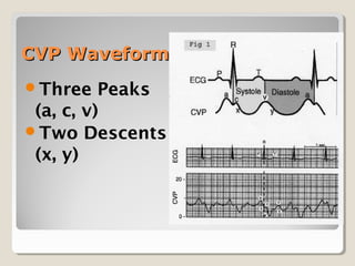 Cvp central venous pressure monitoring | PPT