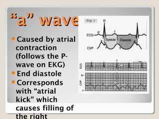 Cvp central venous pressure monitoring | PPT