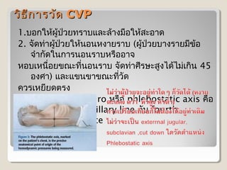 Cvp central venous pressure monitoring | PPT