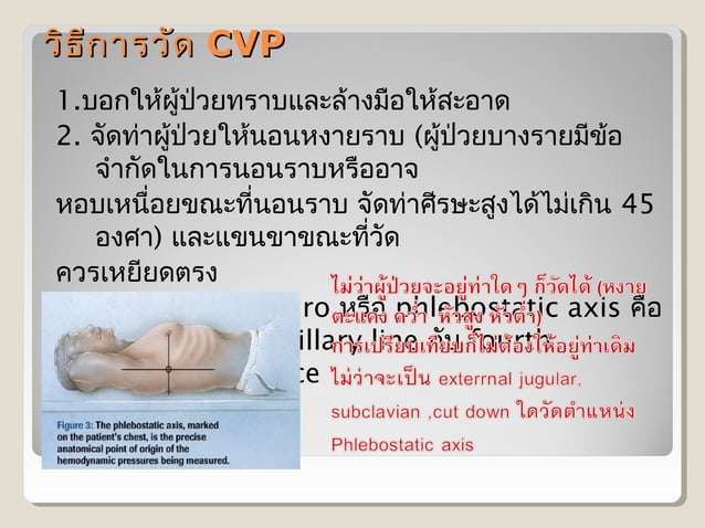 Cvp central venous pressure monitoring | PPT