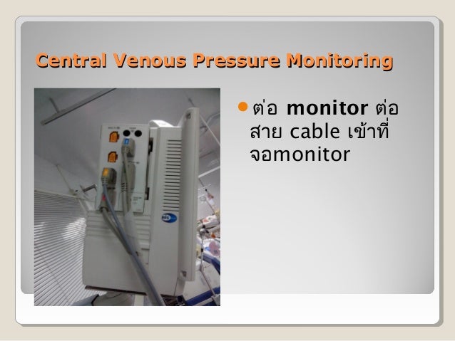 Cvp central venous pressure monitoring