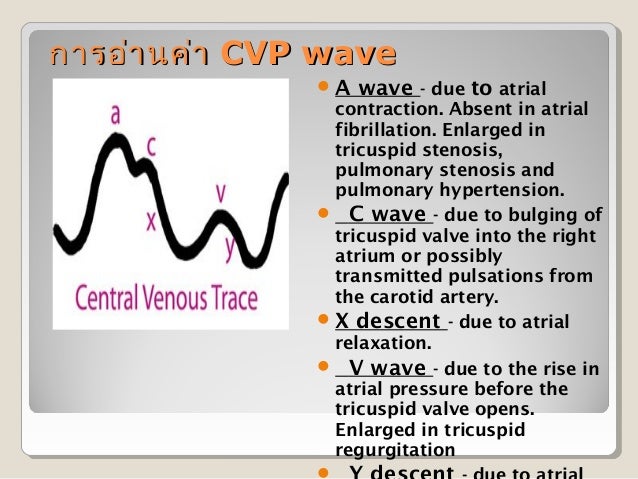 Cvp central venous pressure monitoring