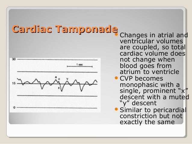 Cvp central venous pressure monitoring
