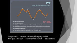 Examination of CVS for undergraduates | PPT