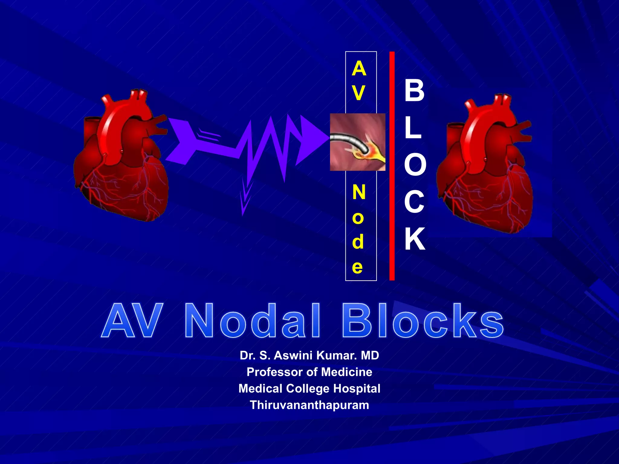 AV Nodal Blocks | PPT