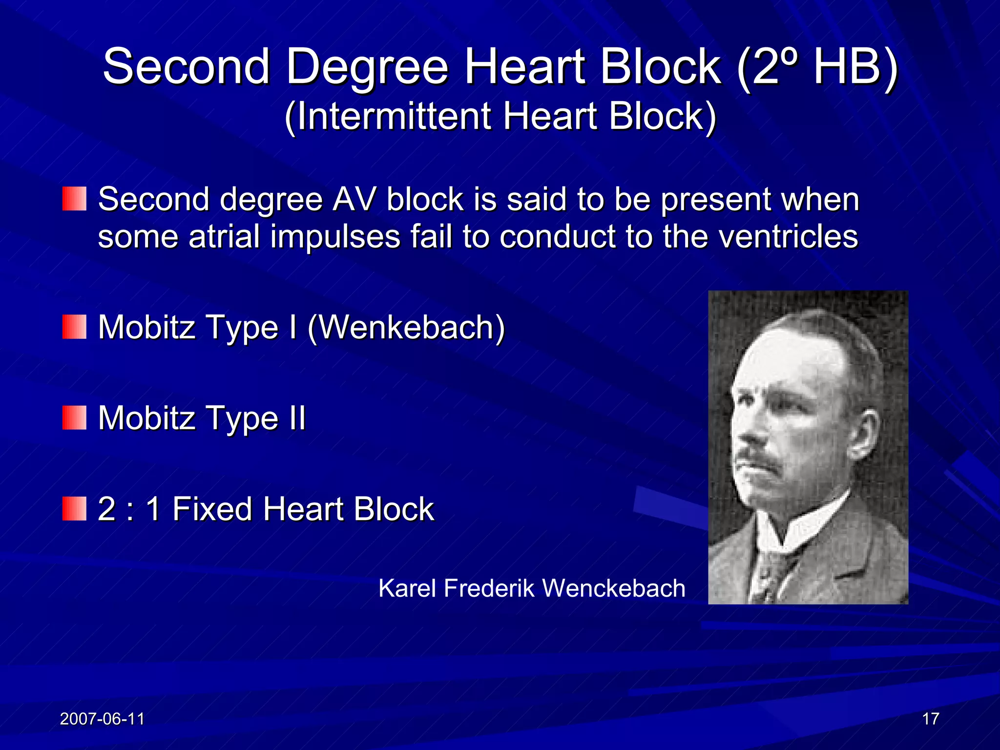 AV Nodal Blocks | PPT