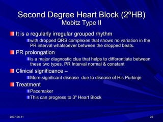 AV Nodal Blocks | PPT