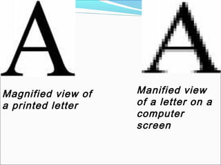 Computer Vision Syndrome | PPT