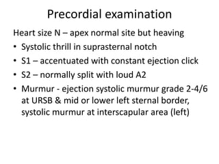 Coarctation of Aorta | PPTX