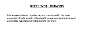 CVS - cyanosis and presyncope.pptx........... | PPTX