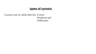CVS - cyanosis and presyncope.pptx........... | PPTX