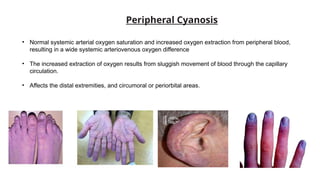 CVS - cyanosis and presyncope.pptx........... | PPTX