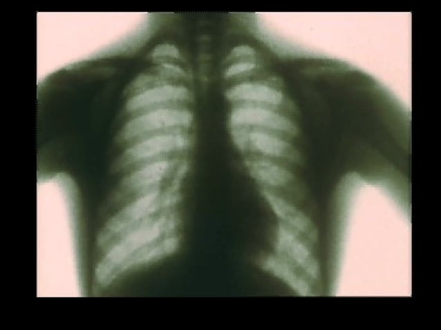 CVS- heart cardiovascular system Anat.ppt