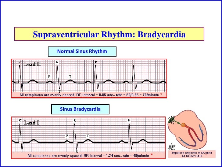 CVS PSL and Monitoring