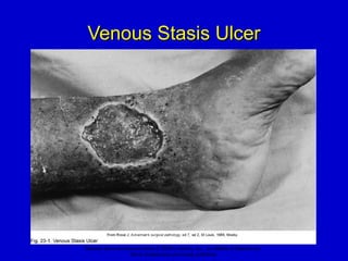 Cardio vascularsystempathophysiology.ppt