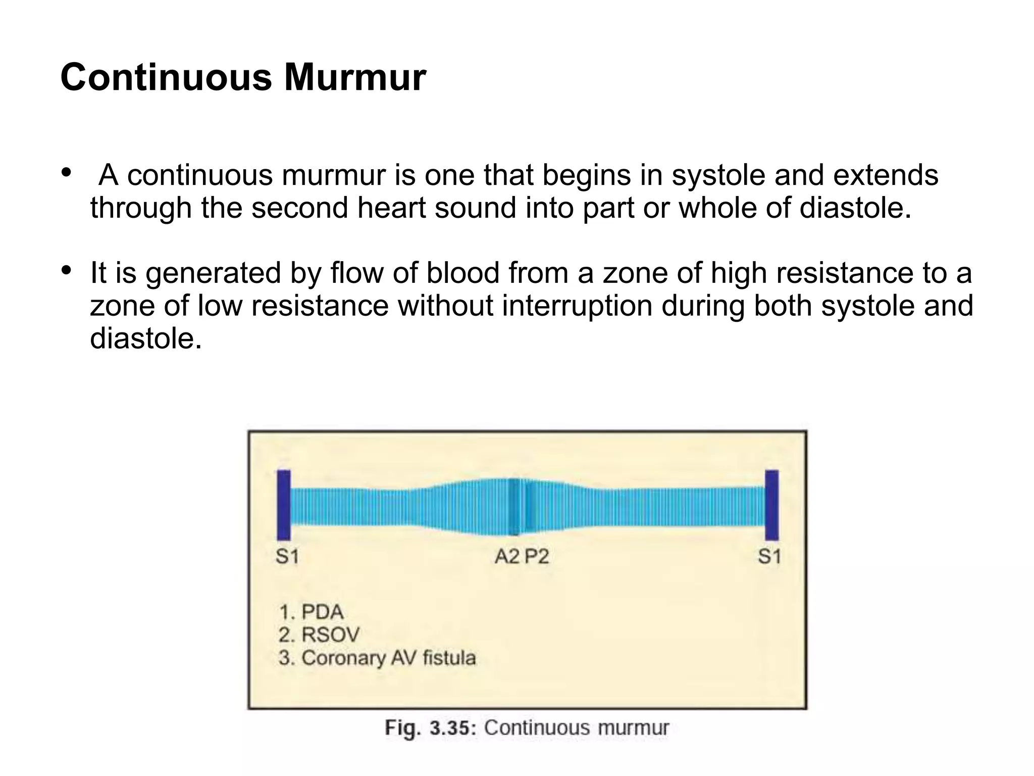 CVS Auscultation .pptx