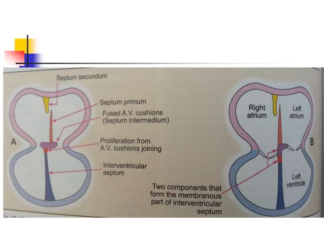 CVS development II 8 June 2023.ppt