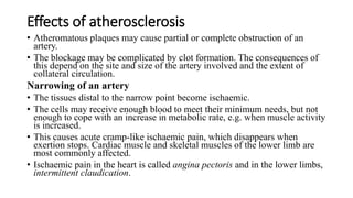 CVS DISORDERS LECTURE 2.pptx