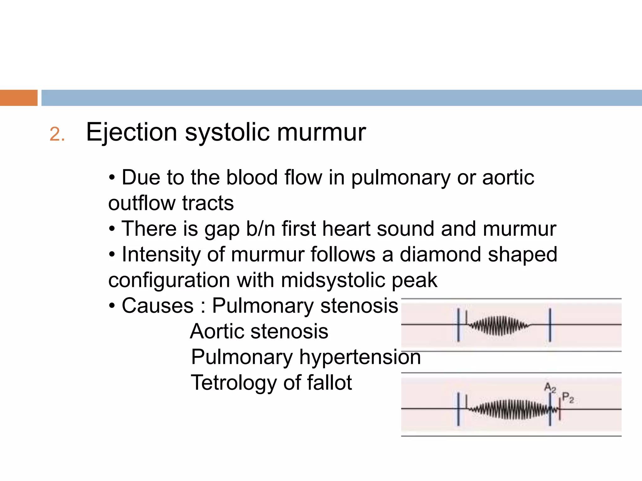 Percussion and Auscultation of CARDIOVASCULAR system. | PPTX