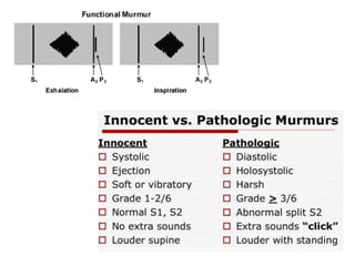 Percussion and Auscultation of CARDIOVASCULAR system. | PPTX
