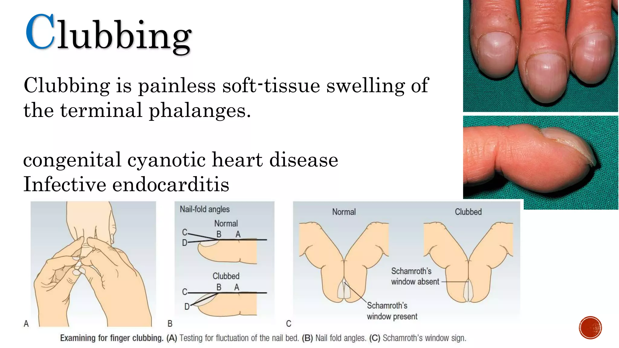 Clinical Examination of CVS | PPTX