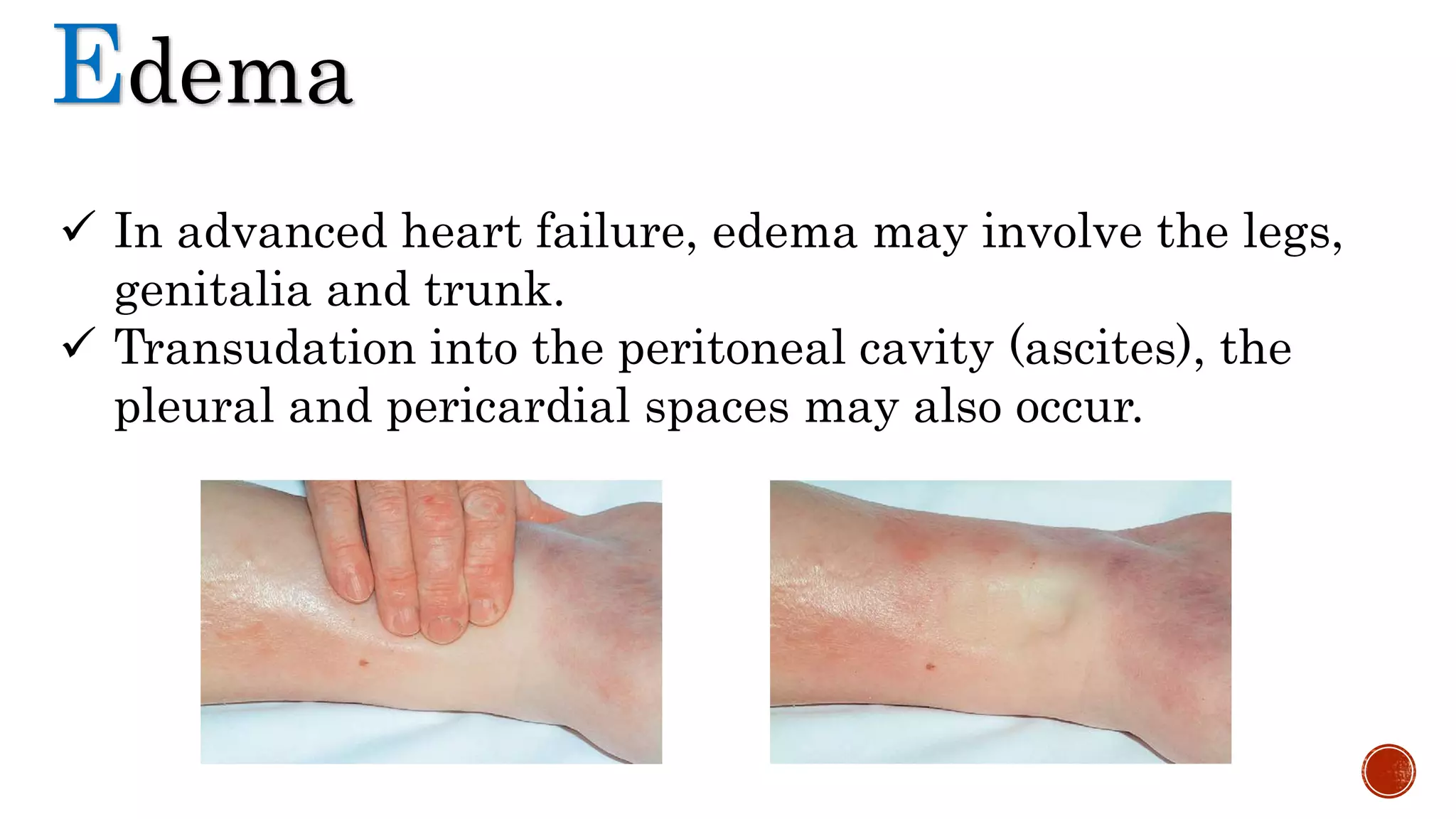 Clinical Examination of CVS | PPTX