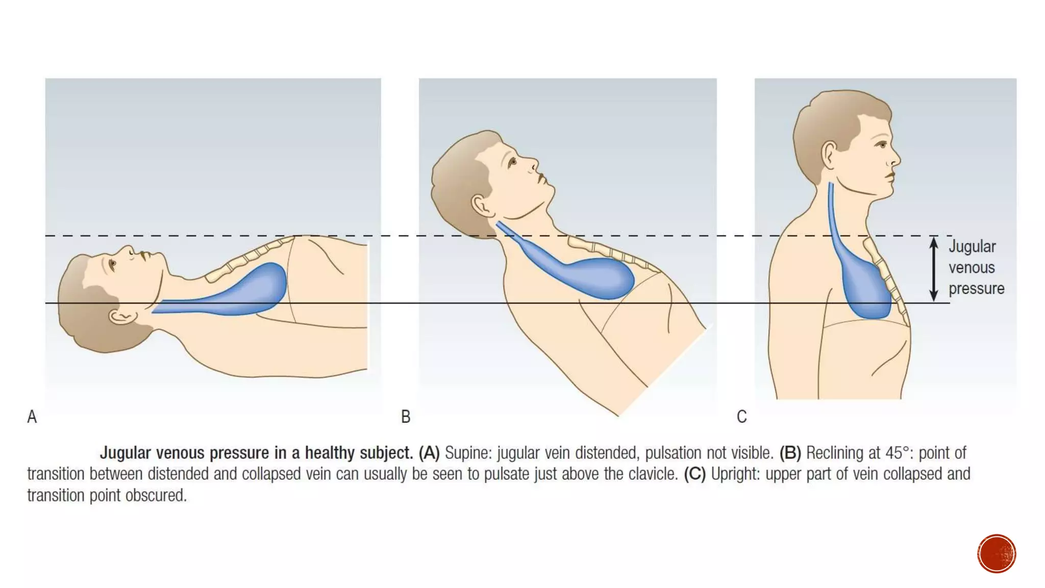 Clinical Examination of CVS | PPTX
