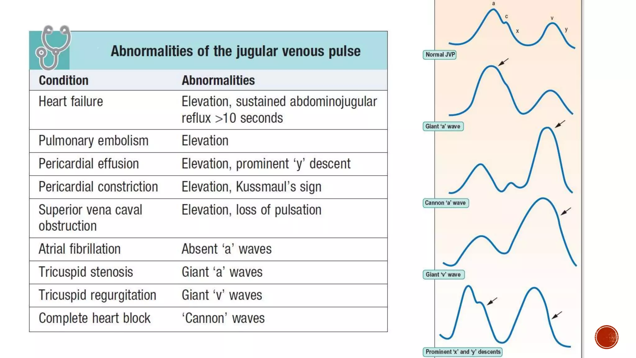 Clinical Examination of CVS | PPTX
