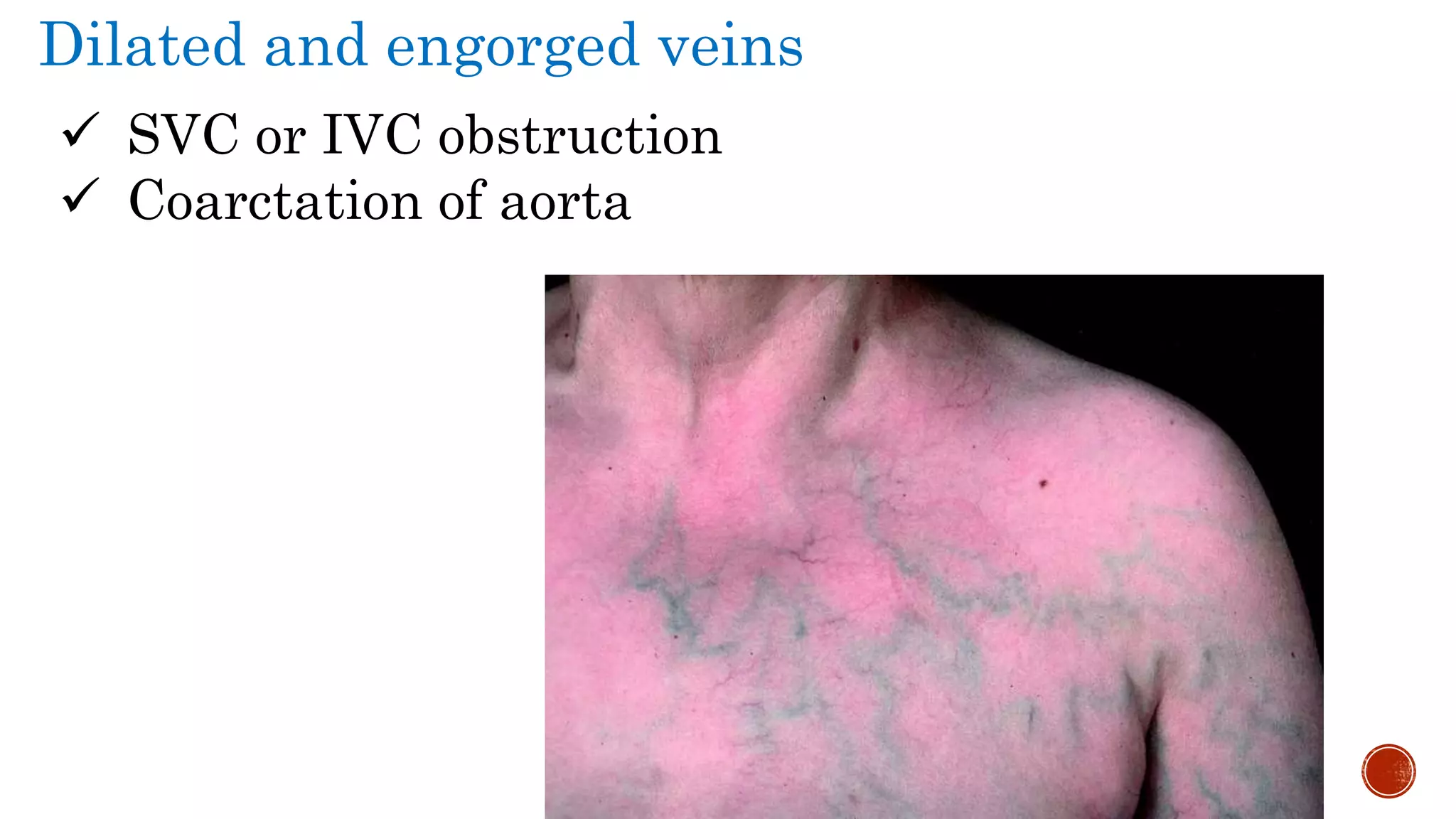 Clinical Examination of CVS | PPTX