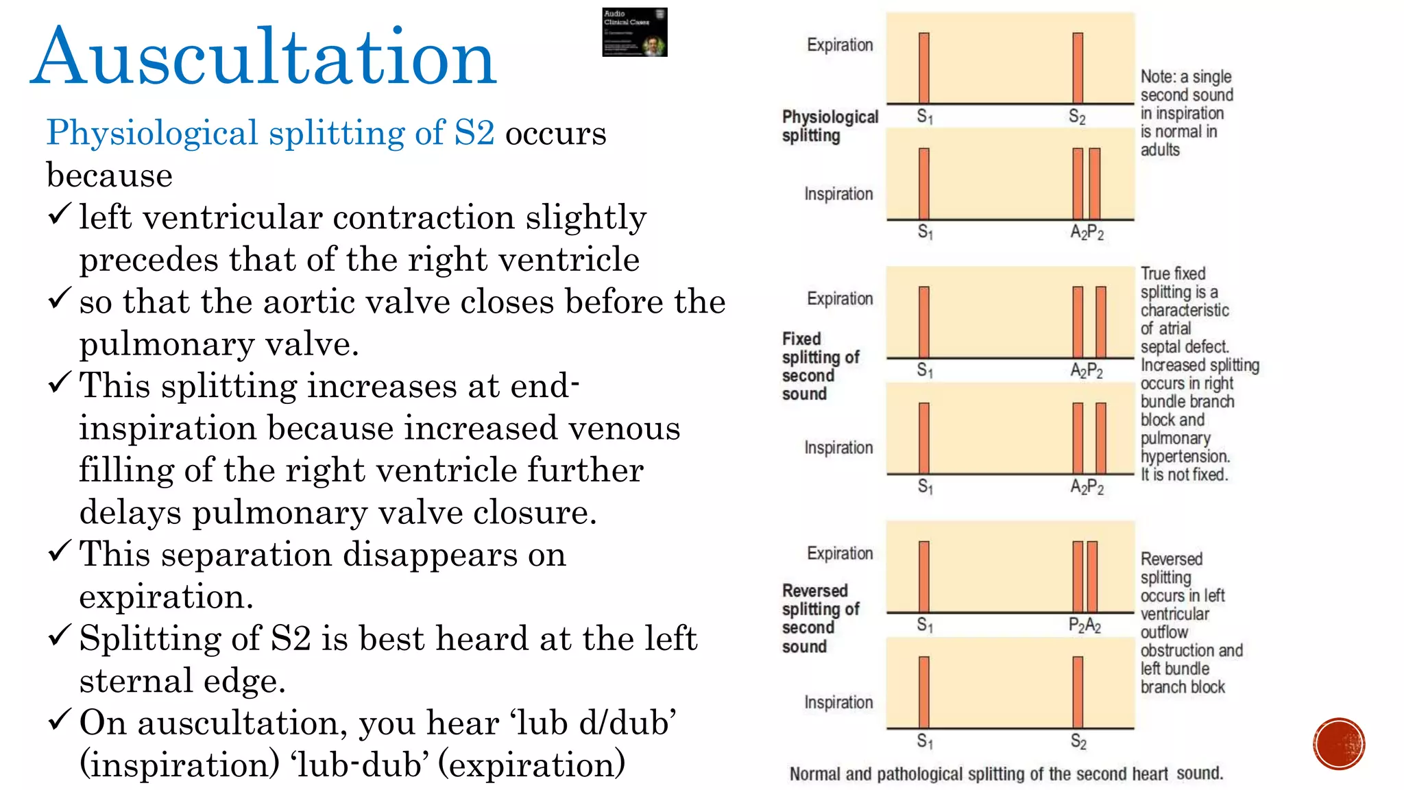 Clinical Examination of CVS | PPTX