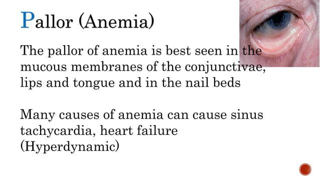 Clinical Examination of CVS | PPTX