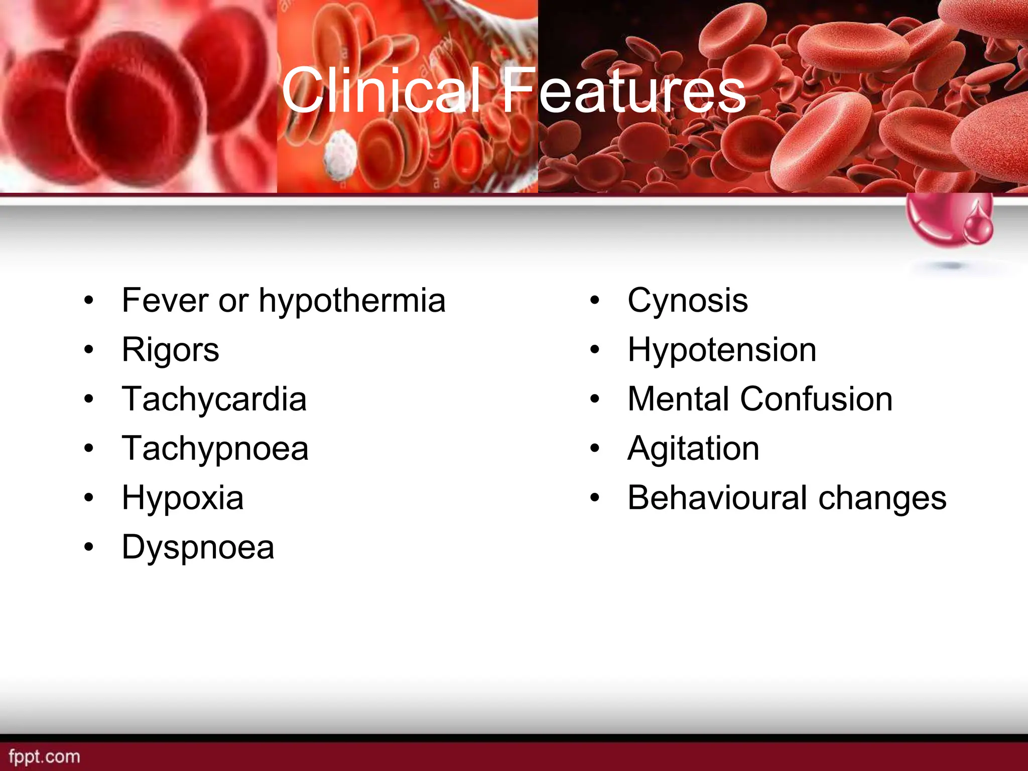 cvs infection....................................... | PPT