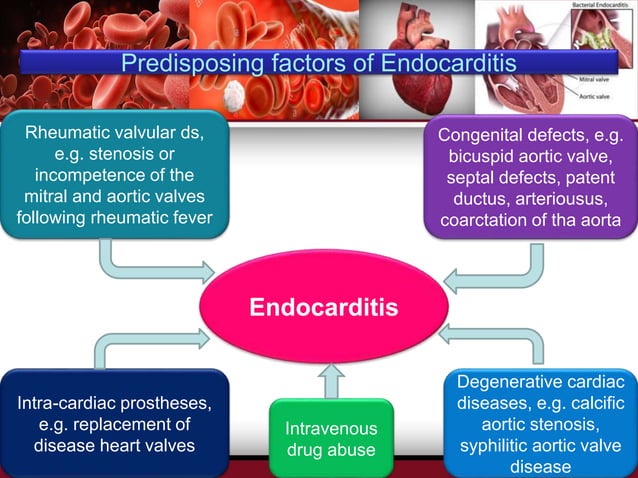 Cardiovascular system infections by Rakesh Prasad Sah | PPT | Heart and ...