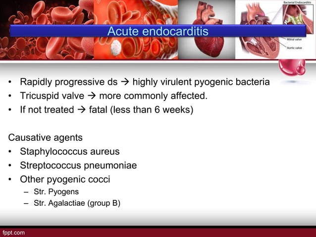 Cardiovascular system infections by Rakesh Prasad Sah | PPT | Heart and ...