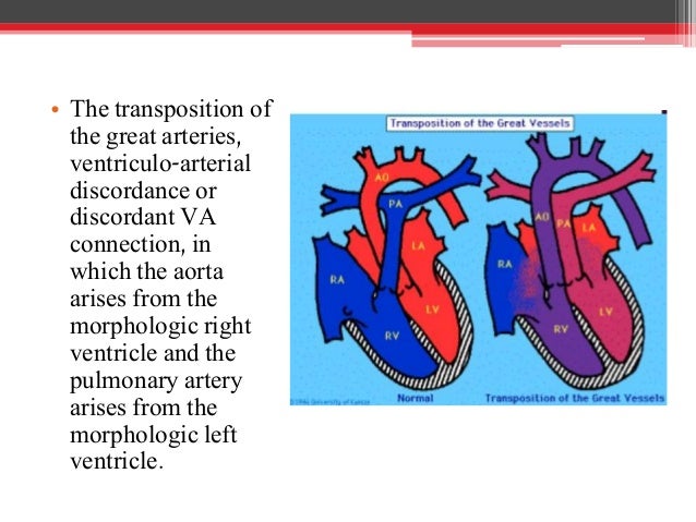 Congenital Heart Disorders (TOF, TGV, COA)