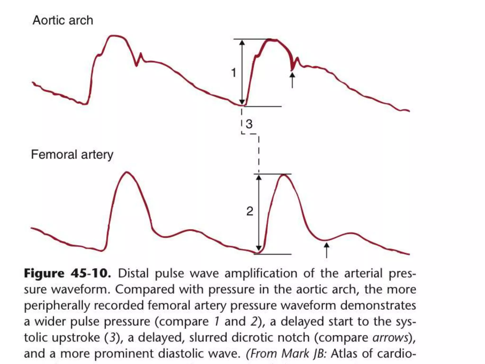 Cardio Vascular Monitoring, Anesthesia | PPTX