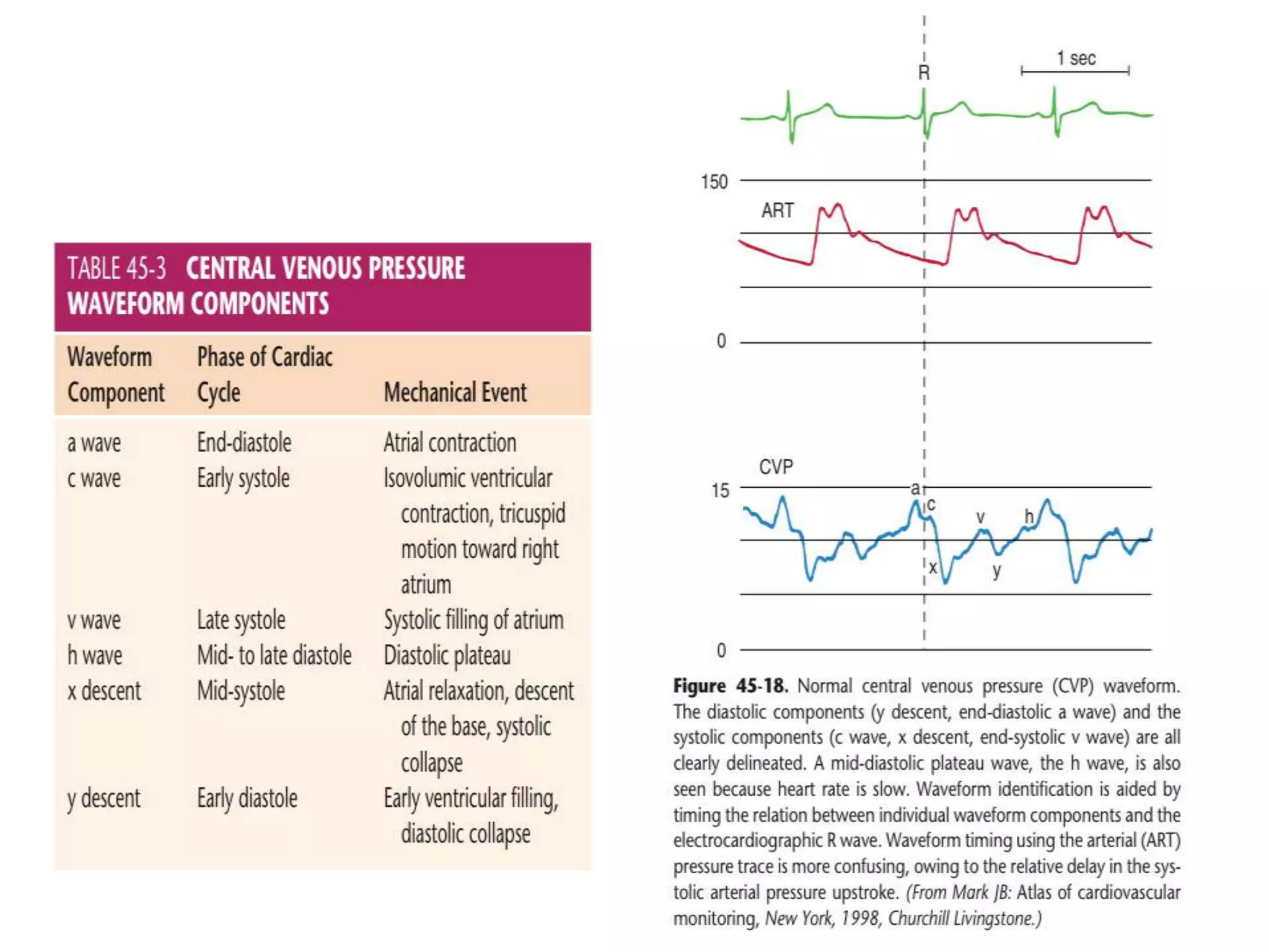 Cardio Vascular Monitoring, Anesthesia | PPTX