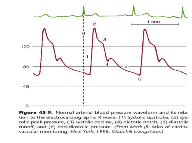 Cardio Vascular Monitoring, Anesthesia | PPTX