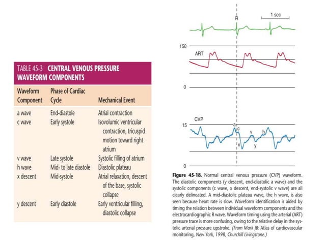 Cardio Vascular Monitoring, Anesthesia | PPTX