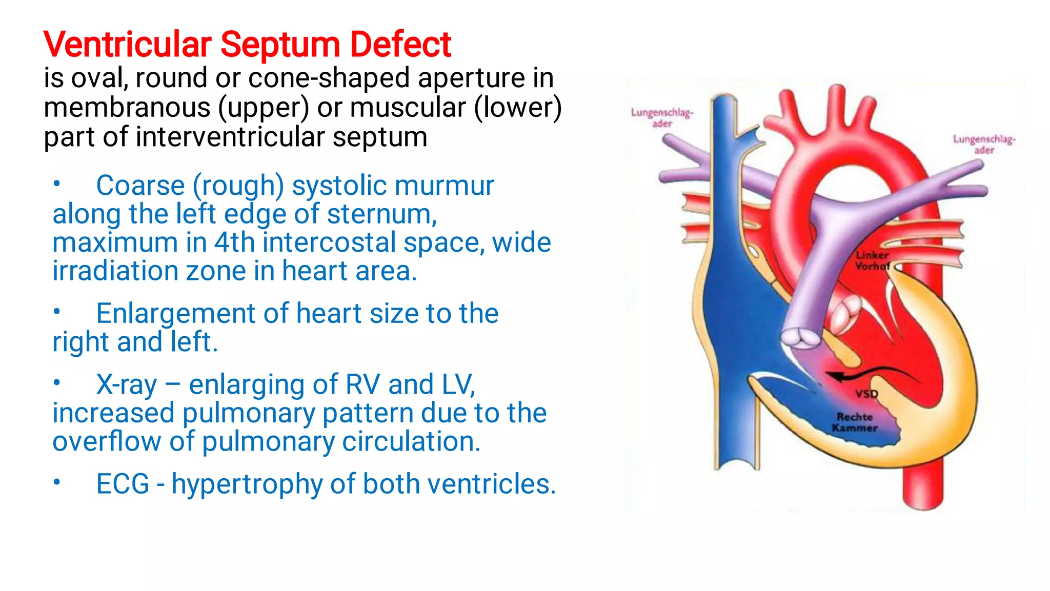 Cardiovascular System (pediatrics) | PDF