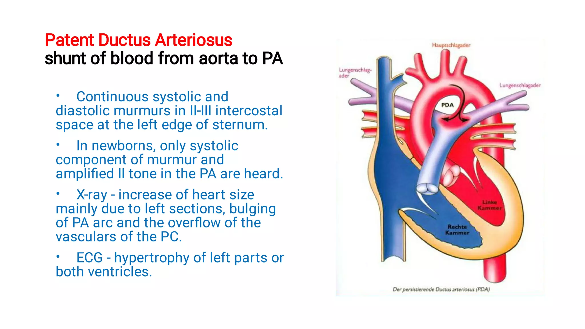 Cardiovascular System (pediatrics) | PDF