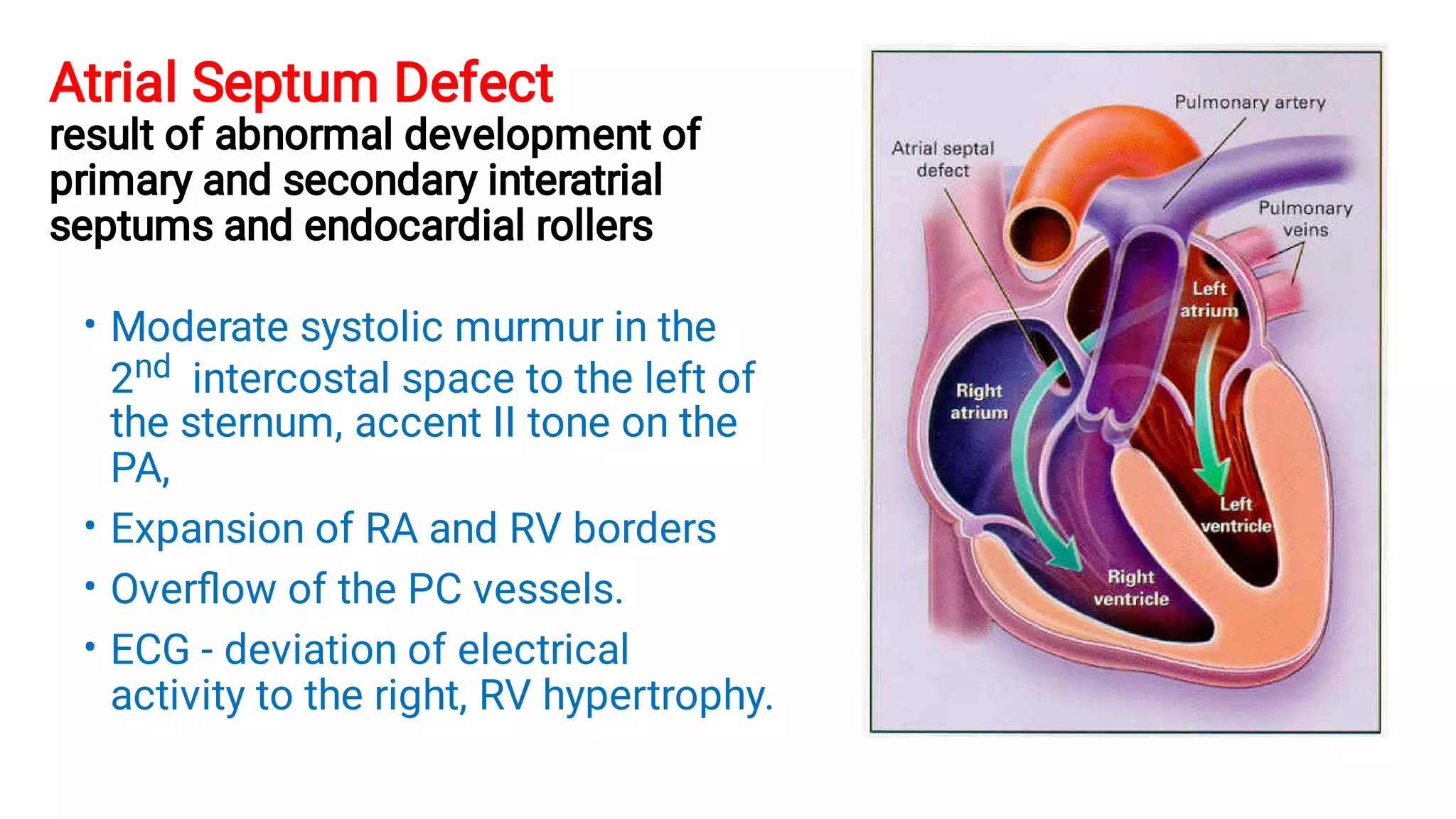 Cardiovascular System (pediatrics) | PDF